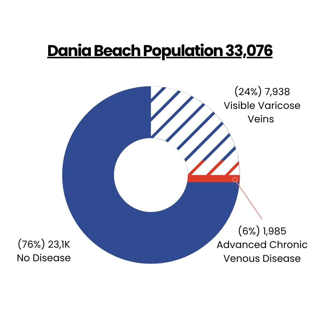 Dania Beach Varicose Vein Specialist | Soffer Health Institute